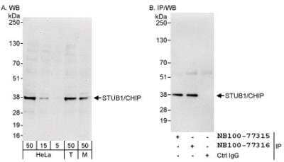 CHIP/STUB1 Antibody (NB100-77315): Novus Biologicals