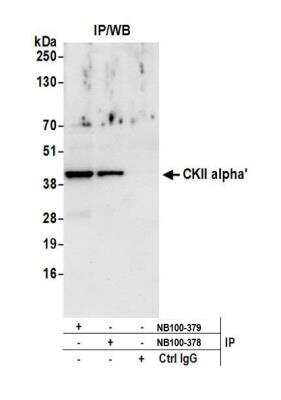CKII alpha prime polypeptide Antibody (NB100-379): Novus Biologicals