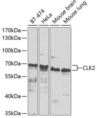 CLK2 Antibody (NBP2-92523): Novus Biologicals