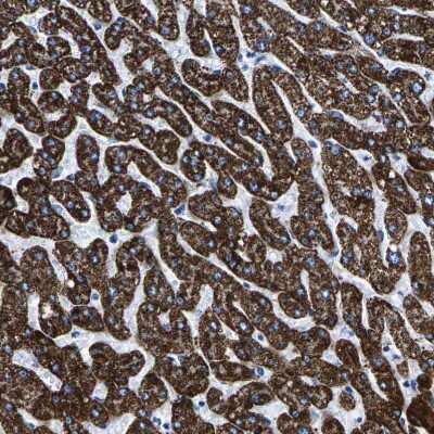 CPS1 Antibody (NBP1-86019): Novus Biologicals
