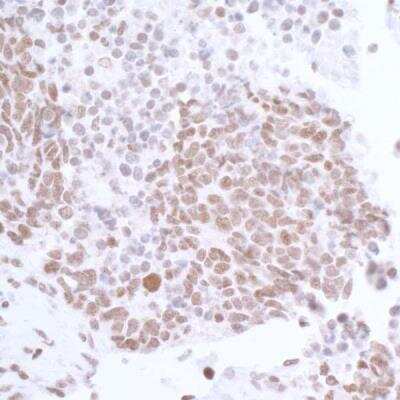 CTCF Antibody (NB500-177): Novus Biologicals