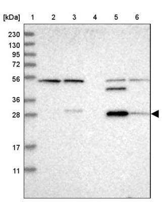 Carbonic Anhydrase XIII/CA13 Research Products: Novus Biologicals