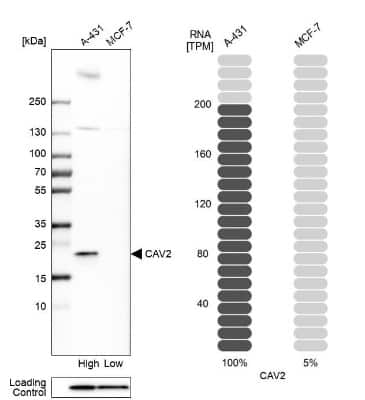Caveolin-2 Antibody (NBP2-33431): Novus Biologicals
