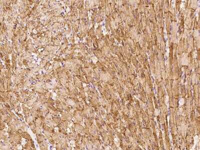 Caveolin-3 Antibody (NBP2-98712): Novus Biologicals