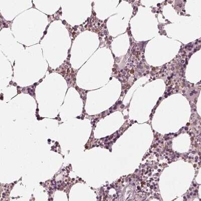 Chitotriosidase/CHIT1 Antibody (NBP1-84490): Novus Biologicals