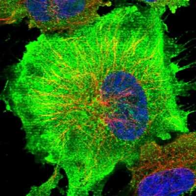 Complement Component C9 Antibody (NBP1-87440): Novus Biologicals