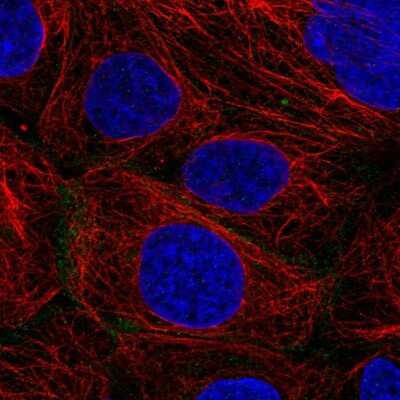 Connexin 31/GJB3 Antibody (NBP2-57376): Novus Biologicals