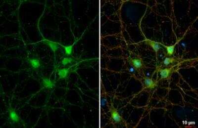 DDR2 Antibody (NBP2-14926): Novus Biologicals