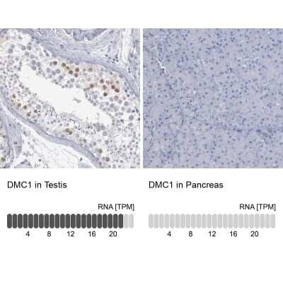 DMC1 Antibody (NBP1-82838): Novus Biologicals