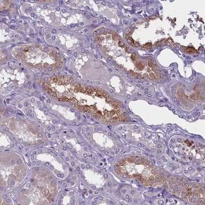 ENPP6 Antibody (NBP1-82710): Novus Biologicals