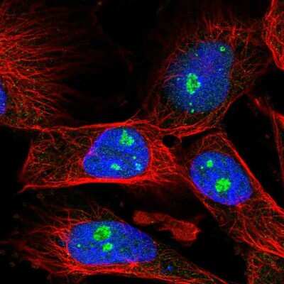 Fibrillarin Antibodies: Novus Biologicals