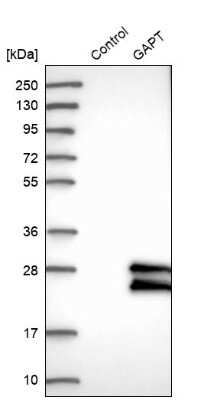 GAPT Antibody (NBP1-86773): Novus Biologicals
