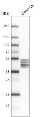 GFAP Antibody (NBP2-33774): Novus Biologicals