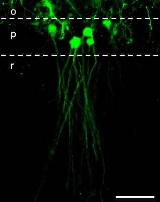 GFP Antibody (NB100-1770): Novus Biologicals