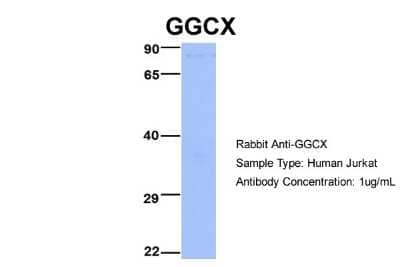 GGCX Antibody (NBP1-59394): Novus Biologicals