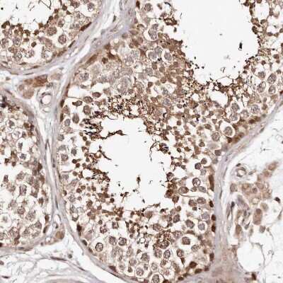 HIVEP3 Antibody (NBP1-93993): Novus Biologicals