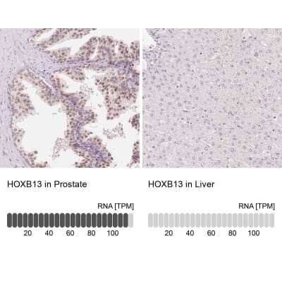HOXB13 Antibodies: Novus Biologicals