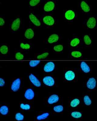 Histone H2AX Antibodies: Novus Biologicals
