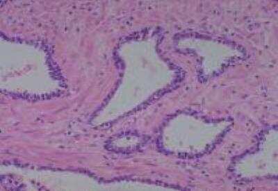 Human Prostate Tissue MicroArray (Cancer) (NBP2-30169): Novus Biologicals