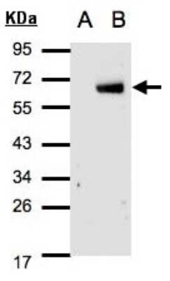 IRF6 Antibody (NBP2-16990): Novus Biologicals