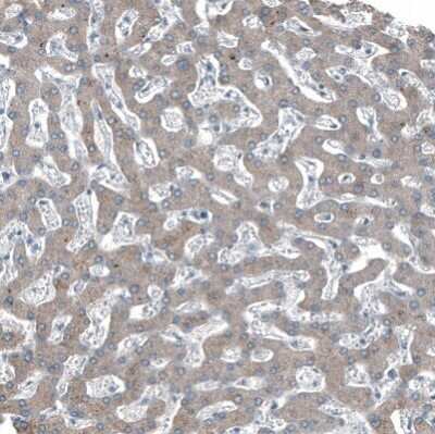 Integrin beta 4/CD104 Antibody (NBP2-38298): Novus Biologicals