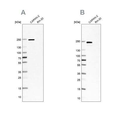 Integrin beta 4/CD104 Antibody (NBP2-38298): Novus Biologicals
