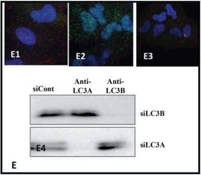 LC3 Antibodies: Novus Biologicals