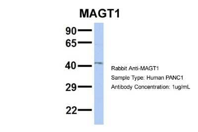 MAGT1 Antibody (NBP1-69683): Novus Biologicals
