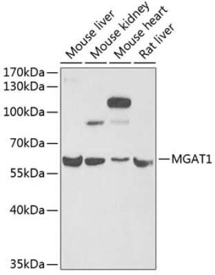 MGAT1 Antibody (NBP3-04742): Novus Biologicals