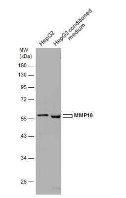 MMP-10 Antibodies: Novus Biologicals