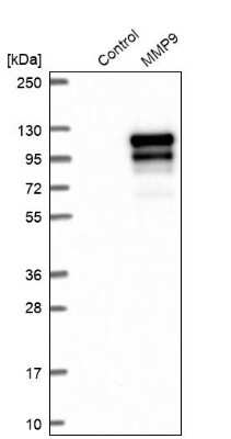 MMP-9 Antibody (NBP2-39011): Novus Biologicals