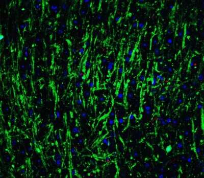 Musashi-2 Antibody - BSA Free (NBP1-76575): Novus Biologicals
