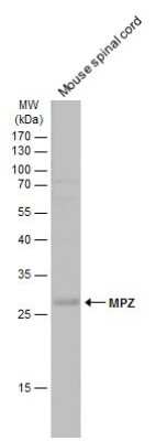 Myelin Protein Zero Antibody (NBP3-13353): Novus Biologicals