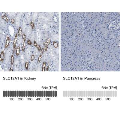 NKCC2/SLC12A1 Antibody (NBP1-82559): Novus Biologicals