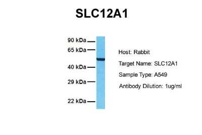 NKCC2/SLC12A1 Antibody (NBP1-57622): Novus Biologicals