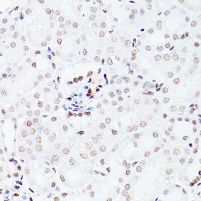 NSUN5 Antibody (NBP3-16628): Novus Biologicals