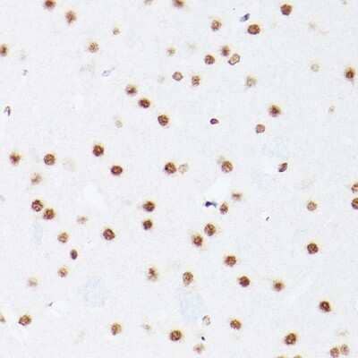 NSUN5 Antibody (NBP3-16628): Novus Biologicals
