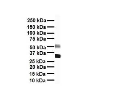 Nav1.6 Antibodies: Novus Biologicals