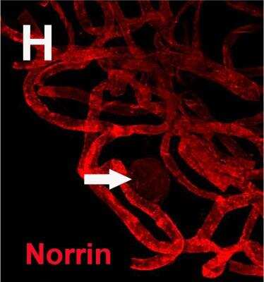 Norrin/NDP Antibody (NBP1-59305): Novus Biologicals