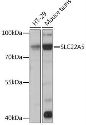 OCTN2/SLC22A5 Antibody (NBP2-94796): Novus Biologicals