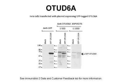 OTUD6A Antibodies: Novus Biologicals