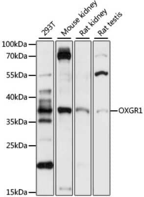 OXGR1/GPR80/P2Y15 Antibody (NBP2-94773): Novus Biologicals