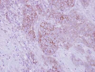Opsin 3 Antibody (NBP2-19629): Novus Biologicals