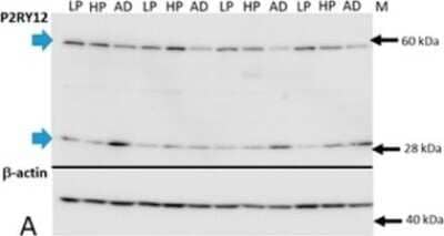 P2Y12/P2RY12 Antibody (NBP2-33870): Novus Biologicals