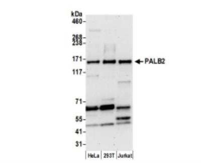 PALB2 Antibody (NB100-60439): Novus Biologicals