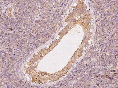 PCM1 Antibody (NBP2-98636): Novus Biologicals