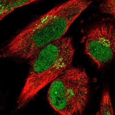 PDIR Antibody (NBP1-92252): Novus Biologicals