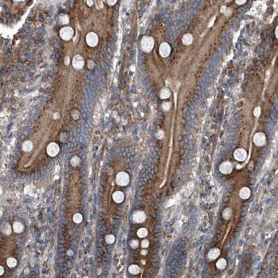 PIGH Antibody (NBP1-83342): Novus Biologicals