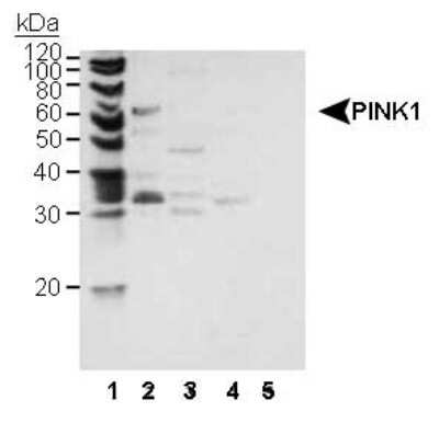 PINK1 Antibodies: Novus Biologicals