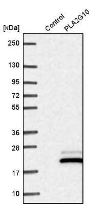PLA2G10 Antibody (NBP1-93706): Novus Biologicals